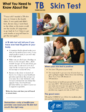 Fillable Online cdc What you need to know about the TB - cdc Fax Email ...