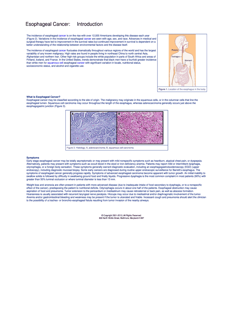 Fillable Online Esophageal Cancer: Fax Email Print - pdfFiller