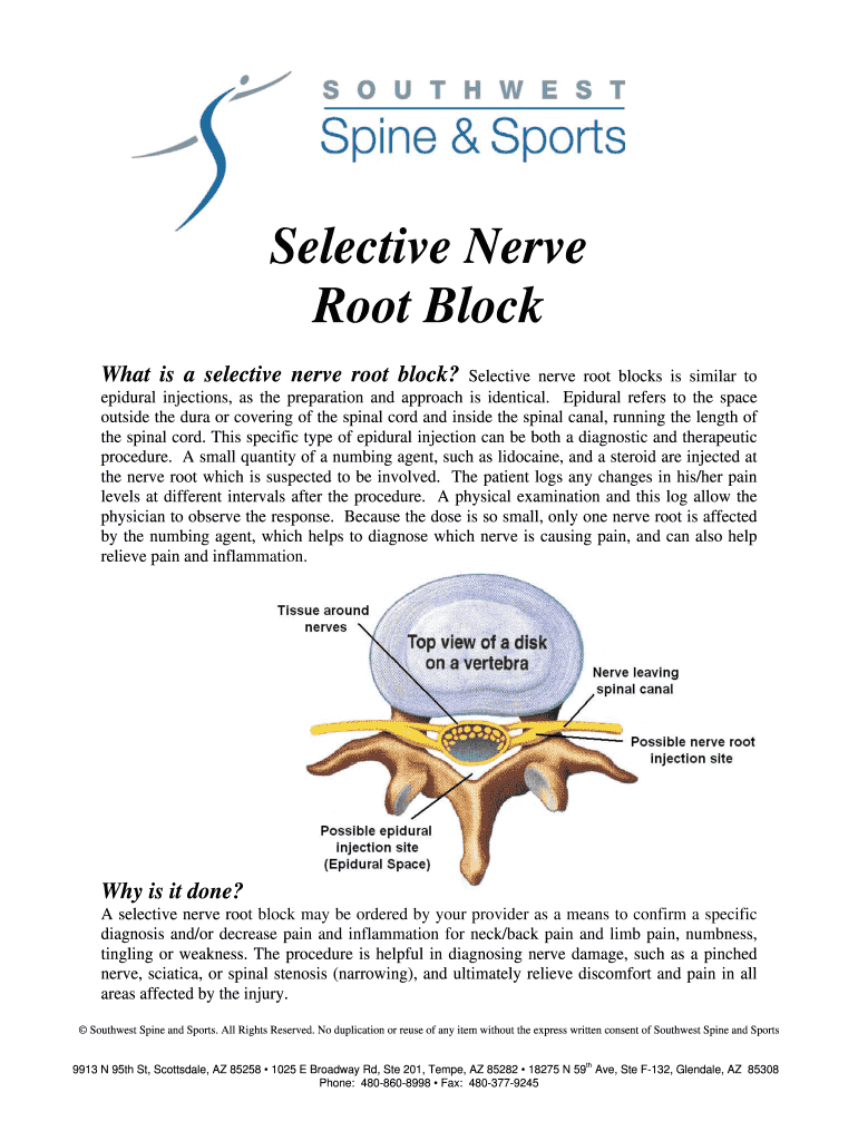 Fillable Online Selective Nerve Root Block What is a selective nerve ...