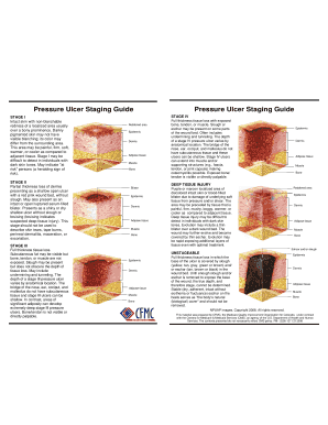 Fillable Online Pressure Ulcer Staging Guide Fax Email Print - pdfFiller
