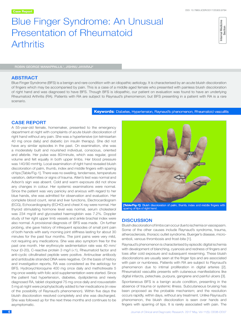 Fillable Online Blue Finger Syndrome: An Unusual Fax Email Print ...