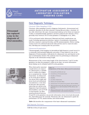 Gti Form 13 - Fill Online, Printable, Fillable, Blank | pdfFiller