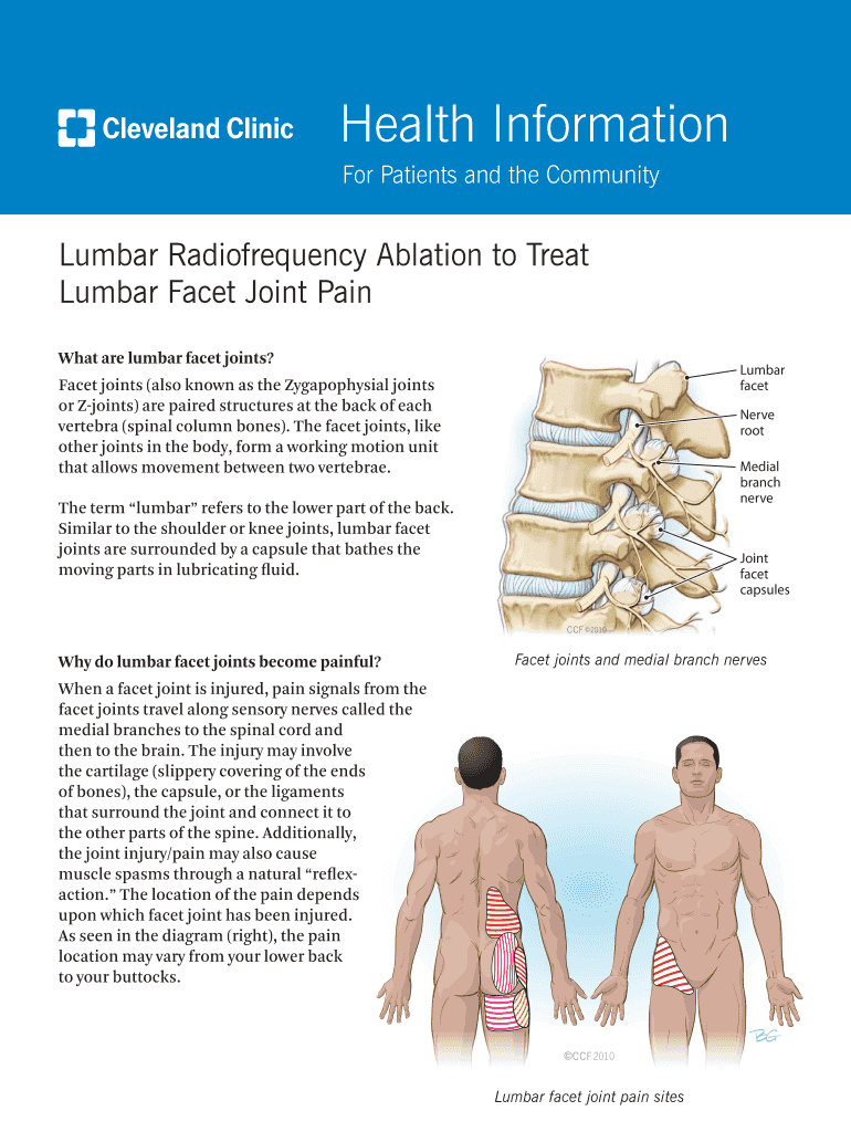 Fillable Online Lumbar Radiofrequency Ablation to Treat Fax Email Print - pdfFiller
