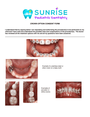 Fillable Online CROWN OPTION CONSENT FORM Fax Email Print - pdfFiller