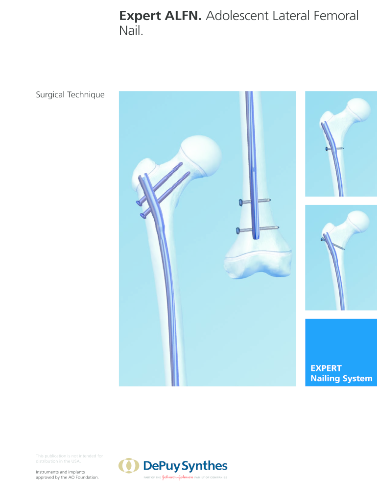 Fillable Online Expert LFN. Lateral Femoral Nail. - synthes.vo.llnwd ...