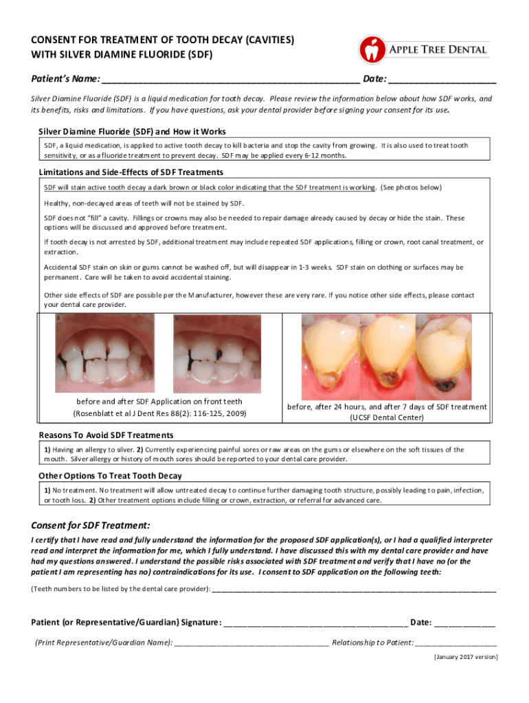 Fillable Online SDF Consent - Little Gold Fish Children's Dentistry Fax ...