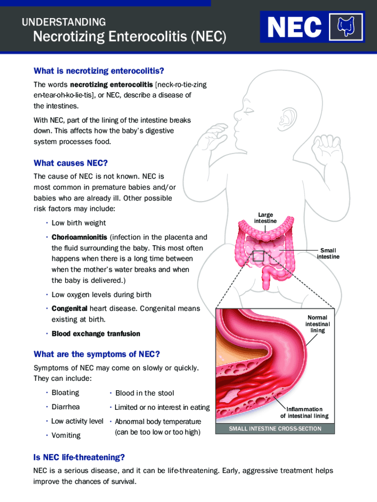 Fillable Online Necrotizing Enterocolitis (NEC): What is it, Causes ...
