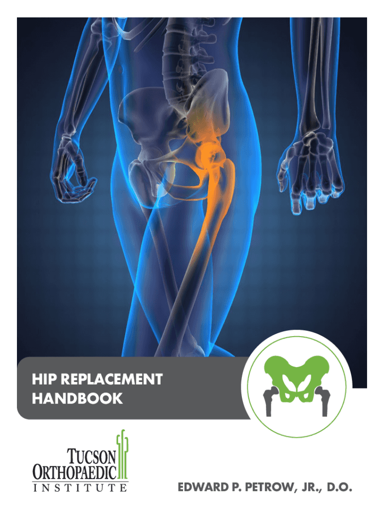Fillable Online HIP REPLACEMENT HANDBOOK Fax Email Print - pdfFiller