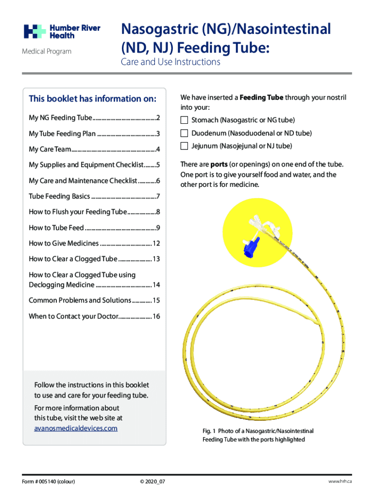 Fillable Online Nasogastric Tube: What It Is, Uses, Types Fax Email ...