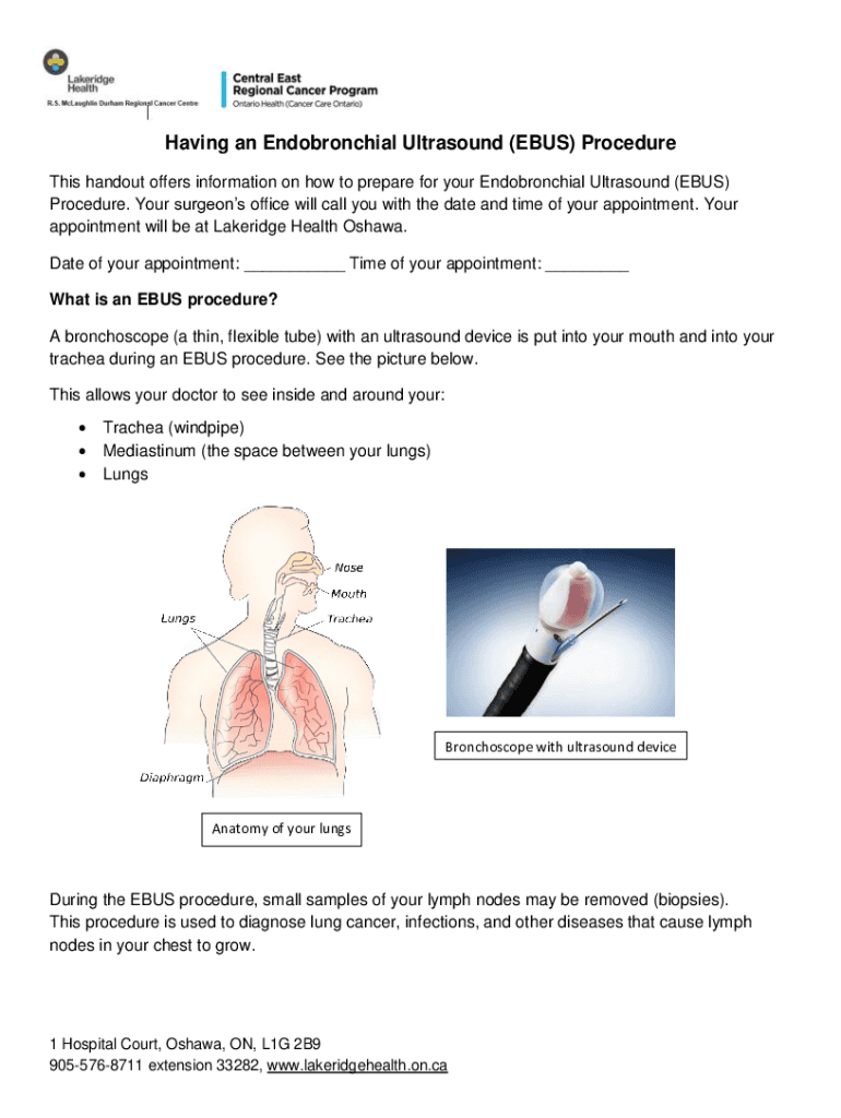 Fillable Online Having an Endobronchial Ultrasound (EBUS) Procedure Fax ...