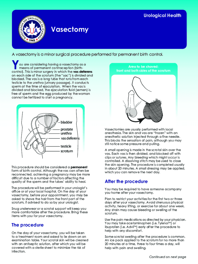 Fillable Online Male Vasectomy ProcedureWhat is a ... Fax Email Print ...
