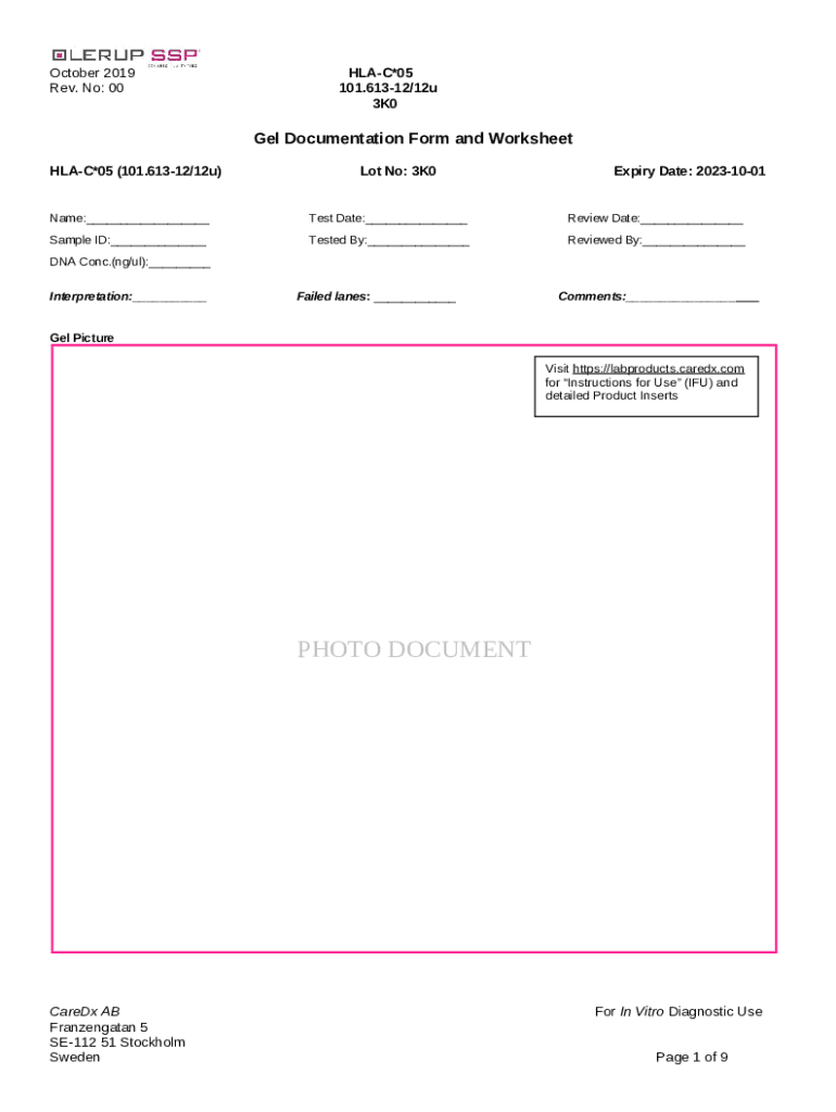 HLA Typing Tests & Solutions Doc Template | pdfFiller