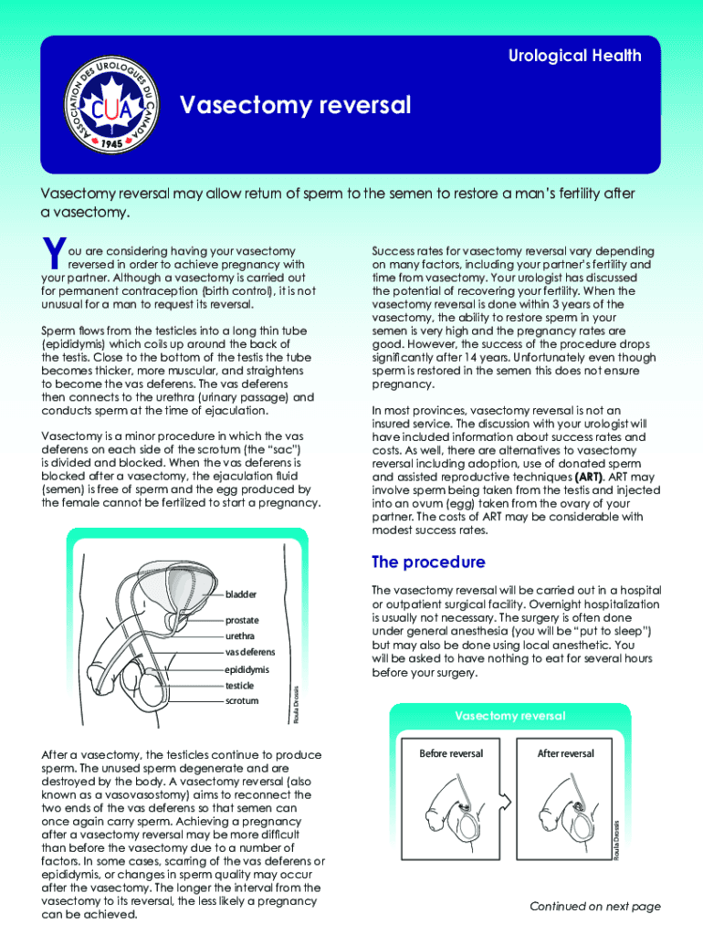 Fillable Online Vasectomy Reversal: Purpose, Procedure & Success Rate ...