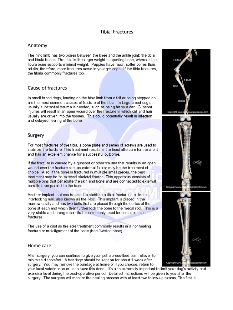 Fillable Online Tibia (Shin Bone): Location, Anatomy & Common ... Fillable Online Tibia (Shin Bone): Location, Anatomy & Common ...