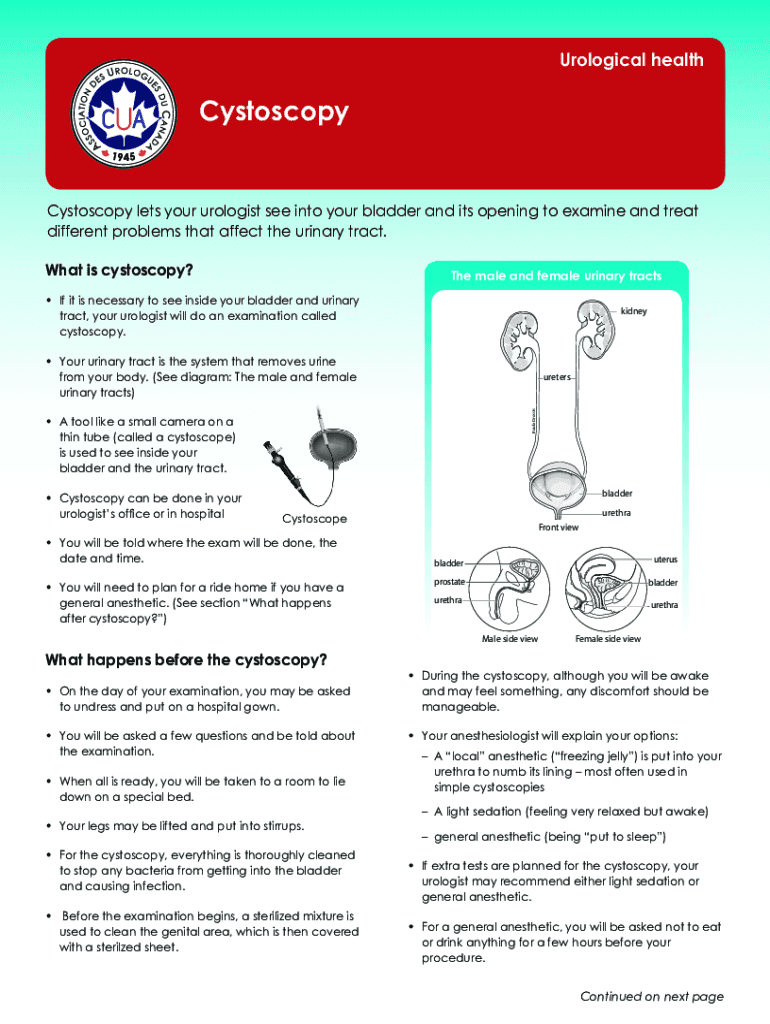 Fillable Online Cystoscopy lets your urologist see into your bladder ...