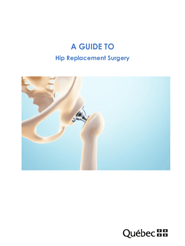 Fillable Online A guide to your Hip Replacement Surgery. Fax Email ...