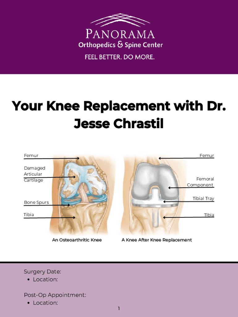 Fillable Online Minimally Invasive Total Knee Replacement - Dr. Jesse ...